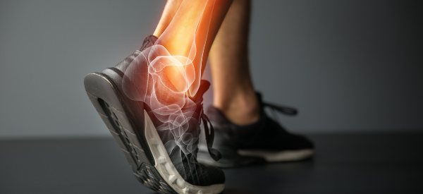 Musculoskeletal health | ODE | REWIND | RCGP Learning